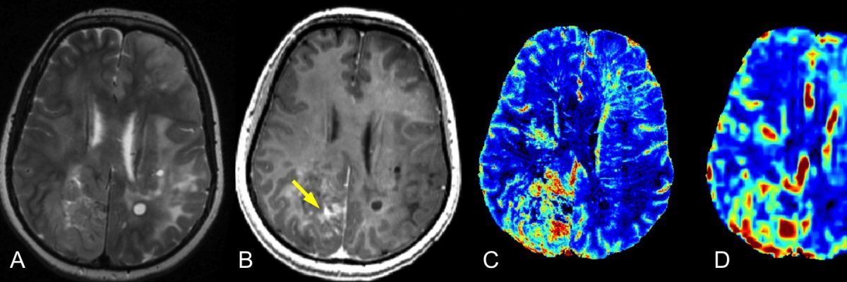 Research – Kate Henne
